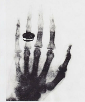 Biografi Wilhelm Conrad Rontgen, Penemu Sinar X Yang Meraih Nobel ...